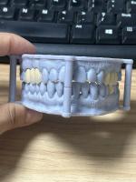 China High Strength Metal-Free Full Zirconia Dental Crown for sale