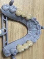 China High Strength Metal-Free Full Zirconia Dental Crown for sale