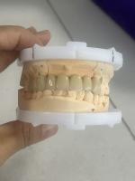 China High Fracture Resistance Full Zirconia Dental Crown with Natural Translucency and CAD/CAM Digital Production for sale