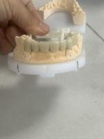 China High Fracture Resistance Full Zirconia Dental Crown with Natural Translucency and CAD/CAM Digital Production for sale