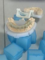 China High Fracture Resistance Full Zirconia Dental Crown with Natural Translucency and CAD/CAM Digital Production for sale