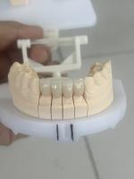 China Custom Full Zirconia Crowns with CAD/CAM Digital Production for Natural Appearance and Biocompatibility for sale