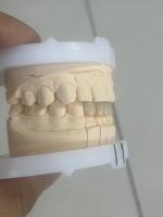 China Custom Full Zirconia Crowns with CAD/CAM Digital Production for Natural Appearance and Biocompatibility for sale