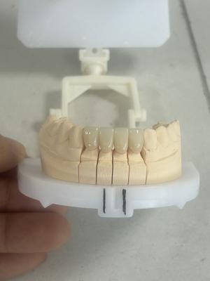 China Custom Full Zirconia Crowns with CAD/CAM Digital Production for Natural Appearance and Biocompatibility for sale