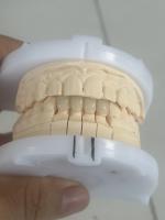 China Custom Full Zirconia Crowns with CAD/CAM Digital Production for Natural Appearance and Biocompatibility for sale