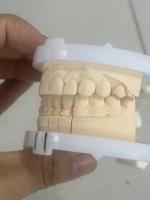 China Custom Full Zirconia Crowns with CAD/CAM Digital Production for Natural Appearance and Biocompatibility for sale