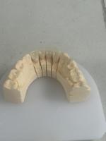 China Custom Full Zirconia Crowns with CAD/CAM Digital Production for Natural Appearance and Biocompatibility for sale