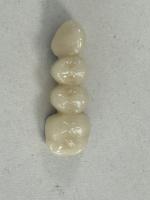 China Cobalt Chrome PFM Crown for sale