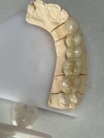 China Custom Full Zirconia Dental Bridge with CAD/CAM Digital Design for Natural-Looking Aesthetics and Metal-Free Restoration for sale