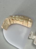 China Custom Full Zirconia Dental Bridge with CAD/CAM Digital Design for Natural-Looking Aesthetics and Metal-Free Restoration for sale