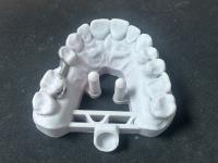 China Conservative Cobalt Chrome No-Prep Dental Bridge with Strong Co-Cr Framework and Precise Digital Design for sale