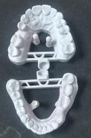 China Conservative Cobalt Chrome No-Prep Dental Bridge with Strong Co-Cr Framework and Precise Digital Design for sale