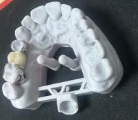 China Conservative Cobalt Chrome No-Prep Dental Bridge with Strong Co-Cr Framework and Precise Digital Design for sale