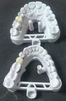 China Conservative Cobalt Chrome No-Prep Dental Bridge with Strong Co-Cr Framework and Precise Digital Design for sale