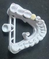 China Conservative Cobalt Chrome No-Prep Dental Bridge with Strong Co-Cr Framework and Precise Digital Design for sale