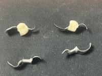 China Conservative Cobalt Chrome No-Prep Dental Bridge with Strong Co-Cr Framework and Precise Digital Design for sale