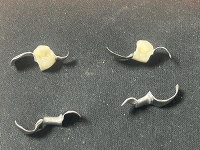 China Conservative Cobalt Chrome No-Prep Dental Bridge with Strong Co-Cr Framework and Precise Digital Design for sale