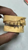 China Custom Orthodontic Appliances  for Personalized Treatment for sale