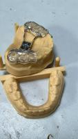 China Custom Orthodontic Appliances  for Personalized Treatment for sale
