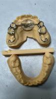 China Custom Orthodontic Appliances  for Personalized Treatment for sale