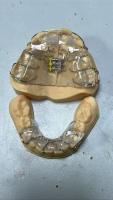China Custom Orthodontic Appliances  for Personalized Treatment for sale