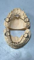 China Custom Orthodontic Appliances  for Personalized Treatment for sale