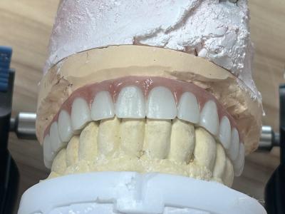 China CAD/CAM Digital Design Full Zirconia Implant Bridge with Natural Tooth-Like Appearance for Full-Arch Restoration for sale