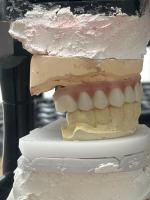 China CAD/CAM Digital Design Full Zirconia Implant Bridge with Natural Tooth-Like Appearance for Full-Arch Restoration for sale