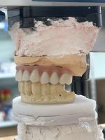 China CAD/CAM Digital Design Full Zirconia Implant Bridge with Natural Tooth-Like Appearance for Full-Arch Restoration for sale