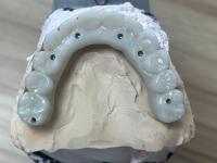 China CAD/CAM Digital Design Full Zirconia Implant Bridge with Natural Tooth-Like Appearance for Full-Arch Restoration for sale