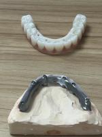 China CAD/CAM Digital Design Full Zirconia Implant Bridge with Natural Tooth-Like Appearance for Full-Arch Restoration for sale