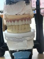 China CAD/CAM Digital Design Full Zirconia Implant Bridge with Natural Tooth-Like Appearance for Full-Arch Restoration for sale