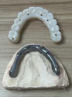 China CAD/CAM Digital Design Full Zirconia Implant Bridge with Natural Tooth-Like Appearance for Full-Arch Restoration for sale