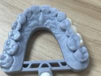 China Composite Veneers & Dental Veneers with Customized Shade, Natural Tooth-Like Appearance for Conservative Restoration for sale