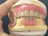 China Customized Gold Teeth with Removable Denture for sale