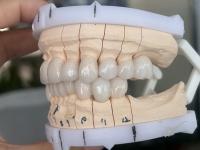 China Full Zirconia Teeth with Monolithic Structure and Natural Tooth-Like Appearance via CAD/CAM Digital Design for sale