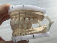 China Full Zirconia Teeth with Monolithic Structure and Natural Tooth-Like Appearance via CAD/CAM Digital Design for sale