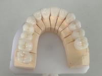 China Full Zirconia Teeth with Monolithic Structure and Natural Tooth-Like Appearance via CAD/CAM Digital Design for sale