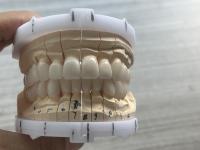 China Full Zirconia Teeth with Monolithic Structure and Natural Tooth-Like Appearance via CAD/CAM Digital Design for sale