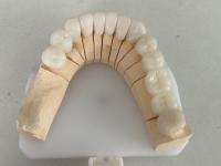 China Full Zirconia Teeth with Monolithic Structure and Natural Tooth-Like Appearance via CAD/CAM Digital Design for sale