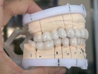 China Full Zirconia Teeth with Monolithic Structure and Natural Tooth-Like Appearance via CAD/CAM Digital Design for sale