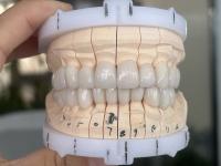 China Full Zirconia Teeth with Monolithic Structure and Natural Tooth-Like Appearance via CAD/CAM Digital Design for sale