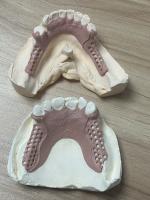 China Lightweight Metal-Free Biocompatible PEEK Partial Denture Framework for Removable Partial Dentures for sale