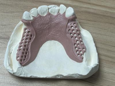 China Lightweight Metal-Free Biocompatible PEEK Partial Denture Framework for Removable Partial Dentures for sale