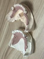 China Lightweight Metal-Free Biocompatible PEEK Partial Denture Framework for Removable Partial Dentures for sale