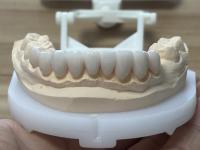 China High Strength All-Zirconia Crowns and Veneers with Natural Tooth-Like Appearance via CAD/CAM Precision Manufacturing for sale