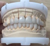 China High Strength All-Zirconia Crowns and Veneers with Natural Tooth-Like Appearance via CAD/CAM Precision Manufacturing for sale