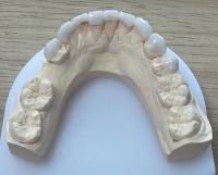 China High Strength All-Zirconia Crowns and Veneers with Natural Tooth-Like Appearance via CAD/CAM Precision Manufacturing for sale