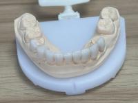China High Strength All-Zirconia Crowns and Veneers with Natural Tooth-Like Appearance via CAD/CAM Precision Manufacturing for sale