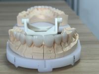 China High Strength All-Zirconia Crowns and Veneers with Natural Tooth-Like Appearance via CAD/CAM Precision Manufacturing for sale